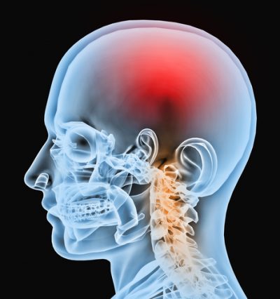 Ecstasy Addiction Odessa | Midland | Springboard Center